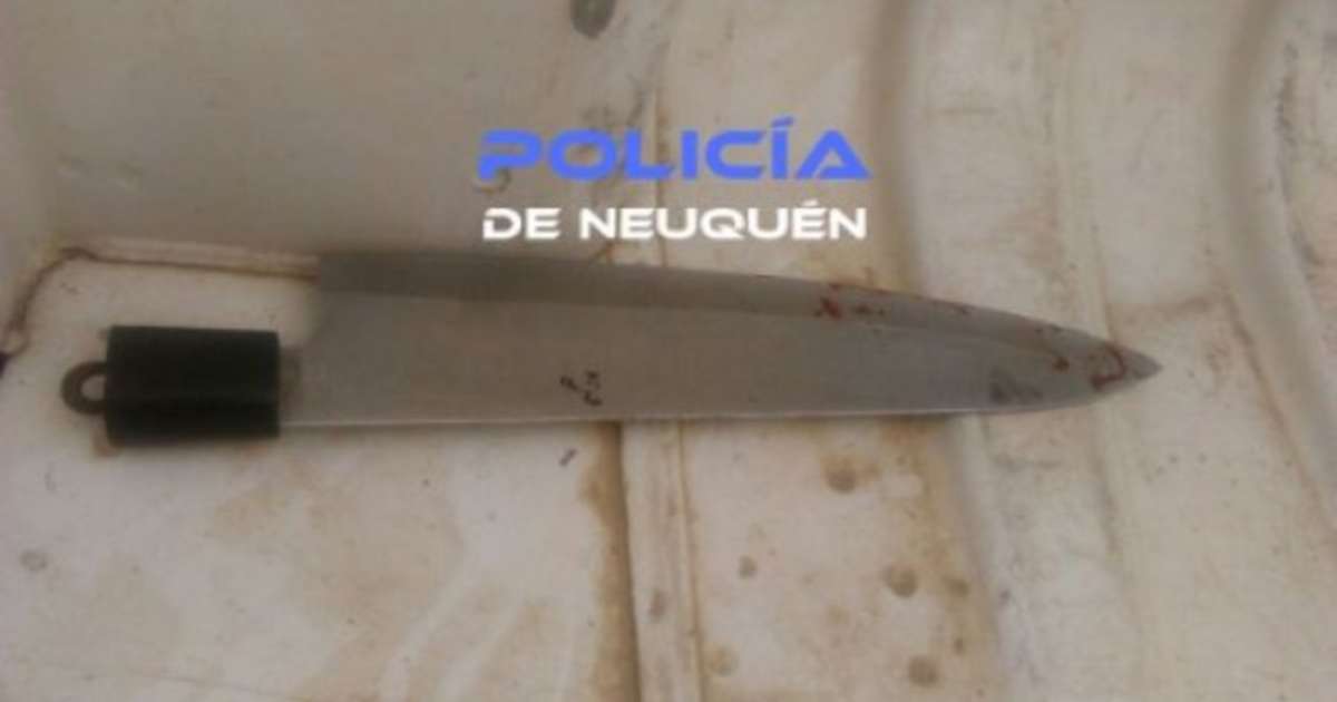 Hirieron de una cuchillada en la cara a un policía | MejorInformado