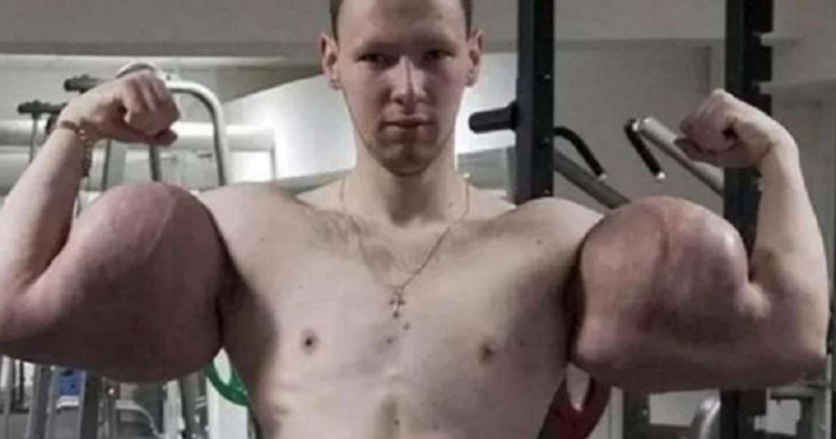 Video: Le explotaron los músculos al "Popeye ruso" | MejorInformado