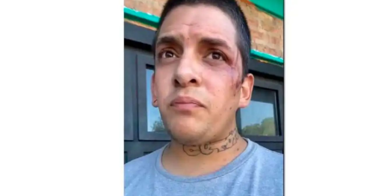 El reconocido rapero "Klan" volcó cerca de Roca | MejorInformado