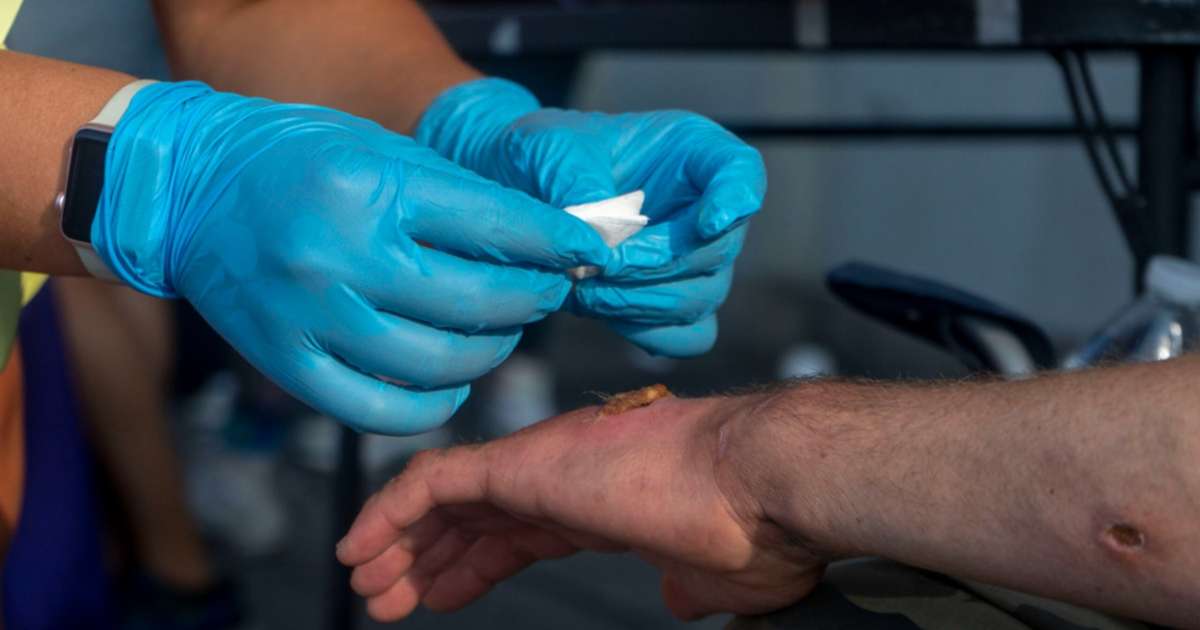 Alerta por “tranq”: la peligrosa droga que llegó a Argentina y preocupa ...